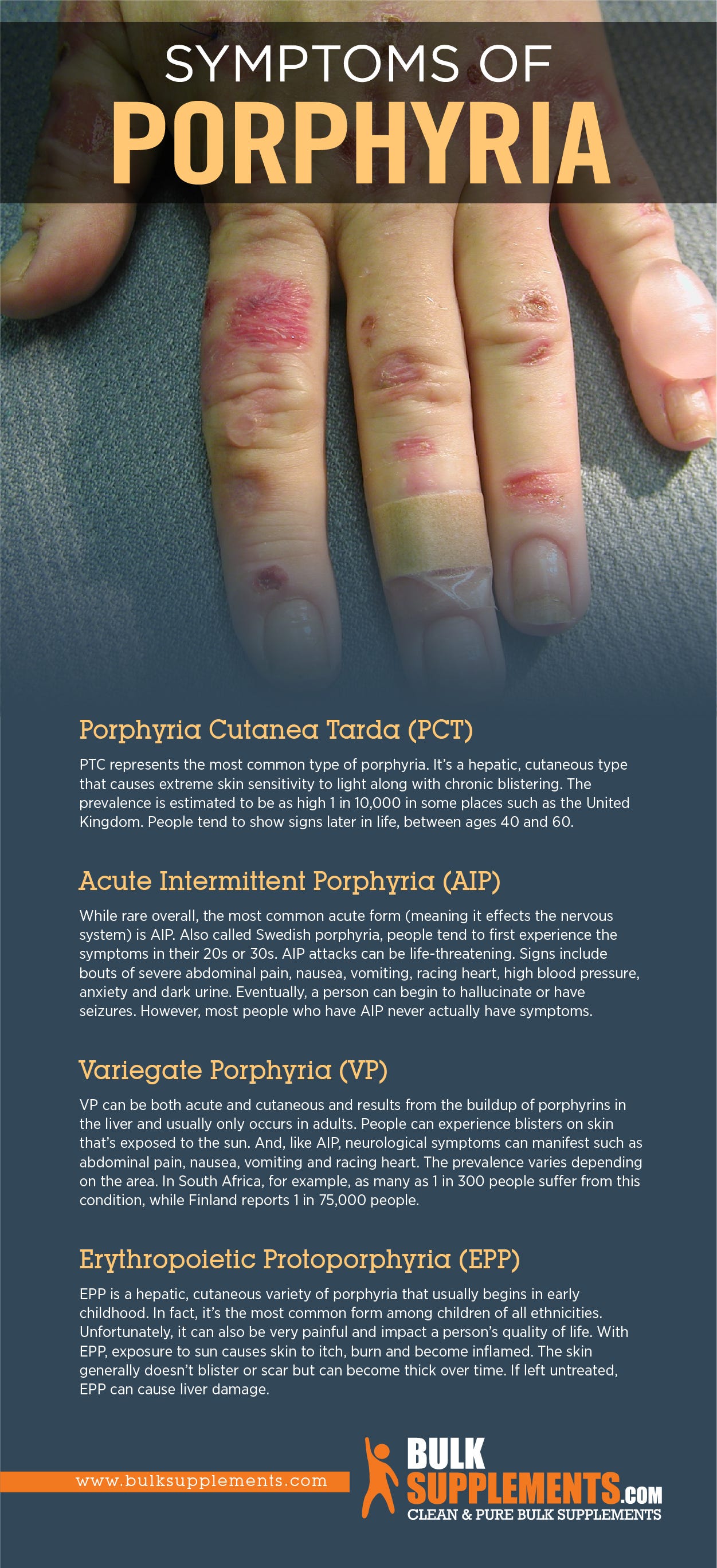 People With Porphyria