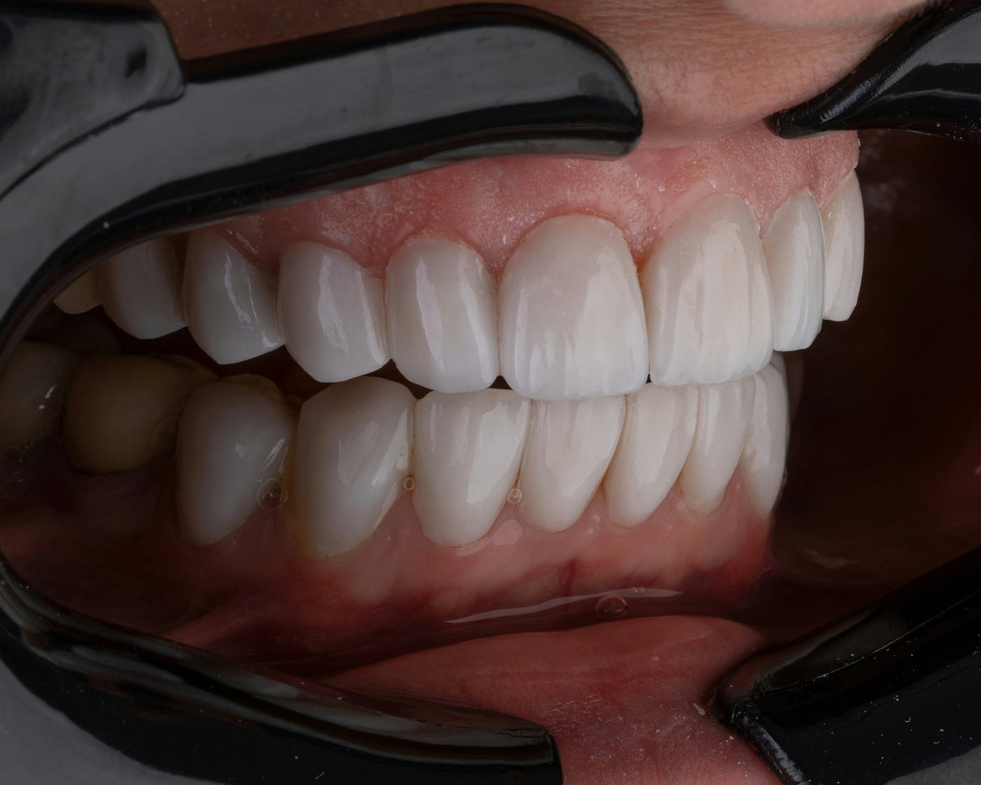 How Many Teeth In A Man's Mouth