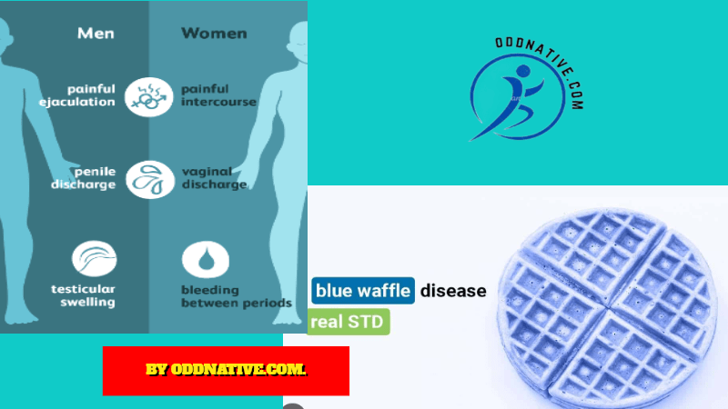 Blue Waffle Disease In Men