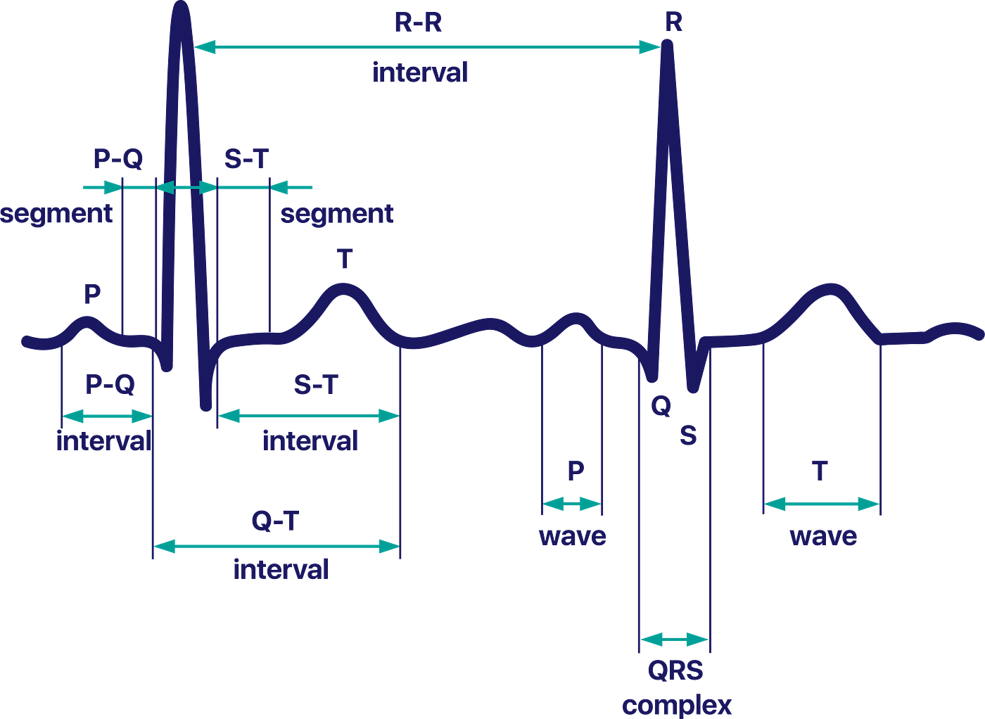 Ecg Waveform