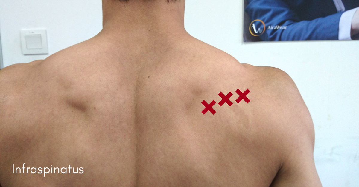 How To Identify Muscle Knots And What To Do About Them