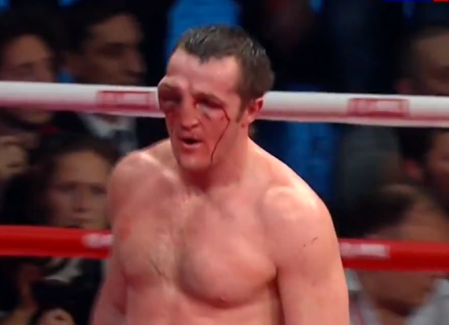 Swollen Face Boxer