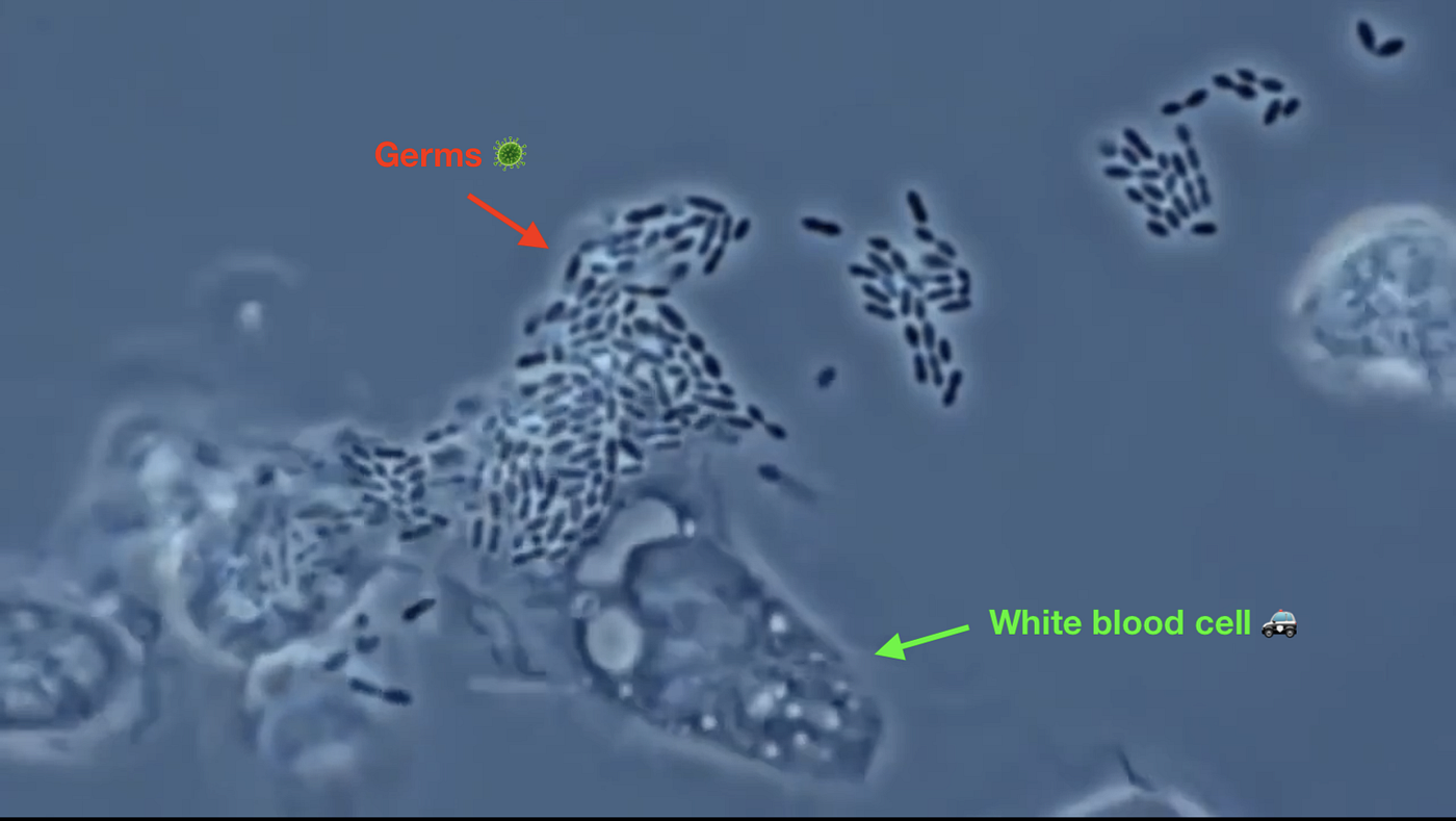 White Blood Cell Eating Bacteria How To Donate White Blood Cells