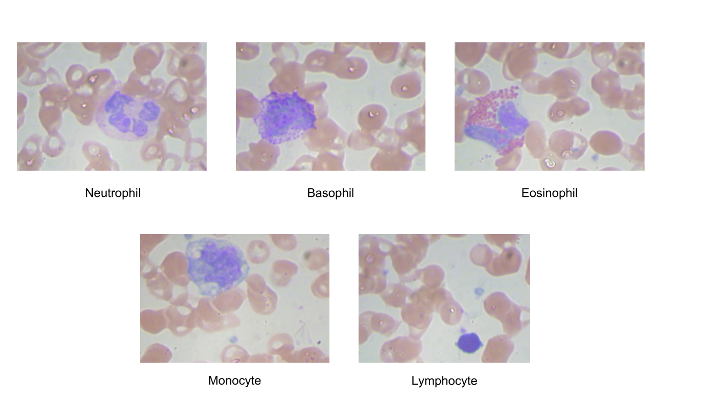 Different Types Of White Blood Cells Under Microscope Micropedia