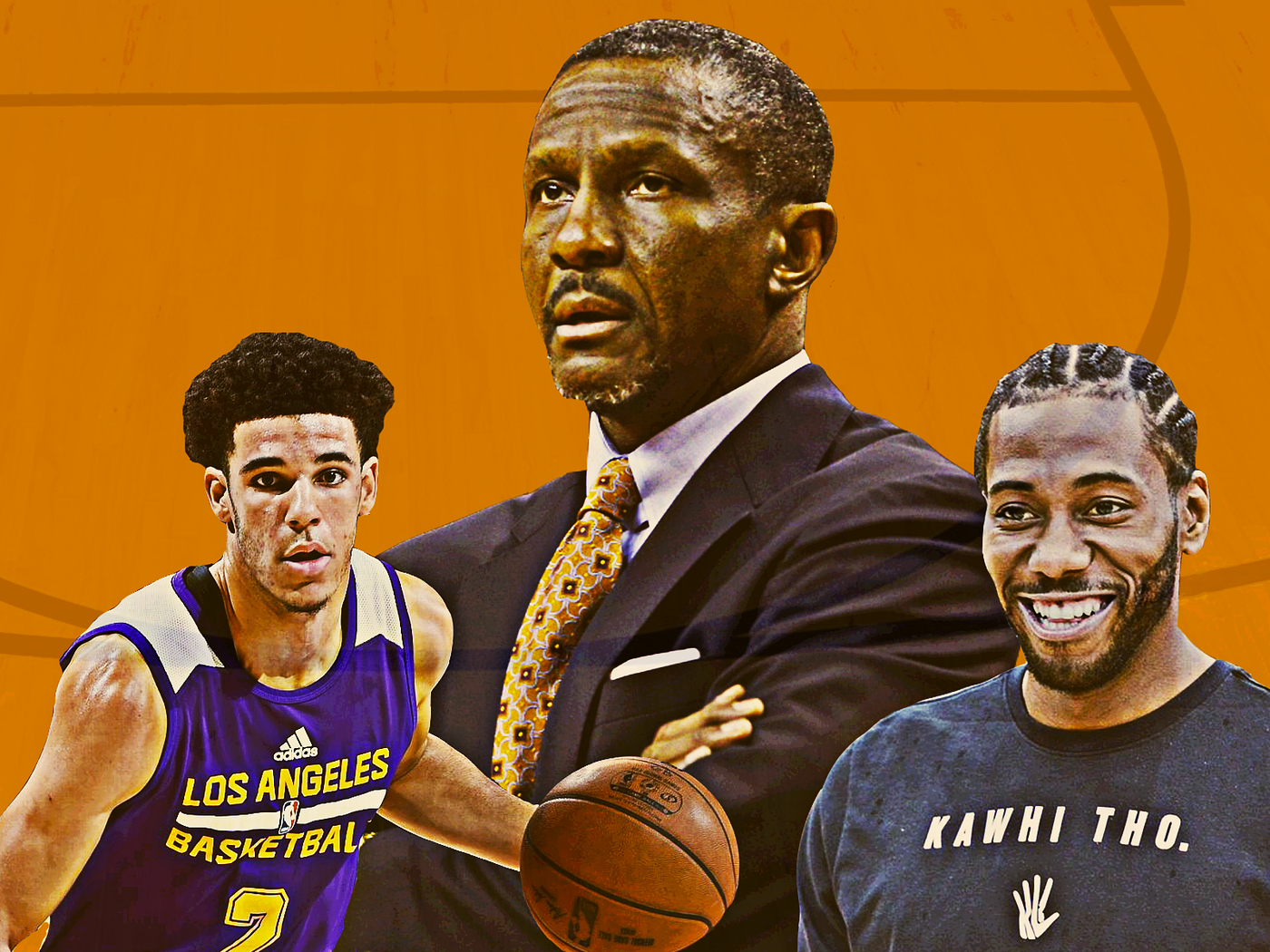 Worst Hairlines In The Nba