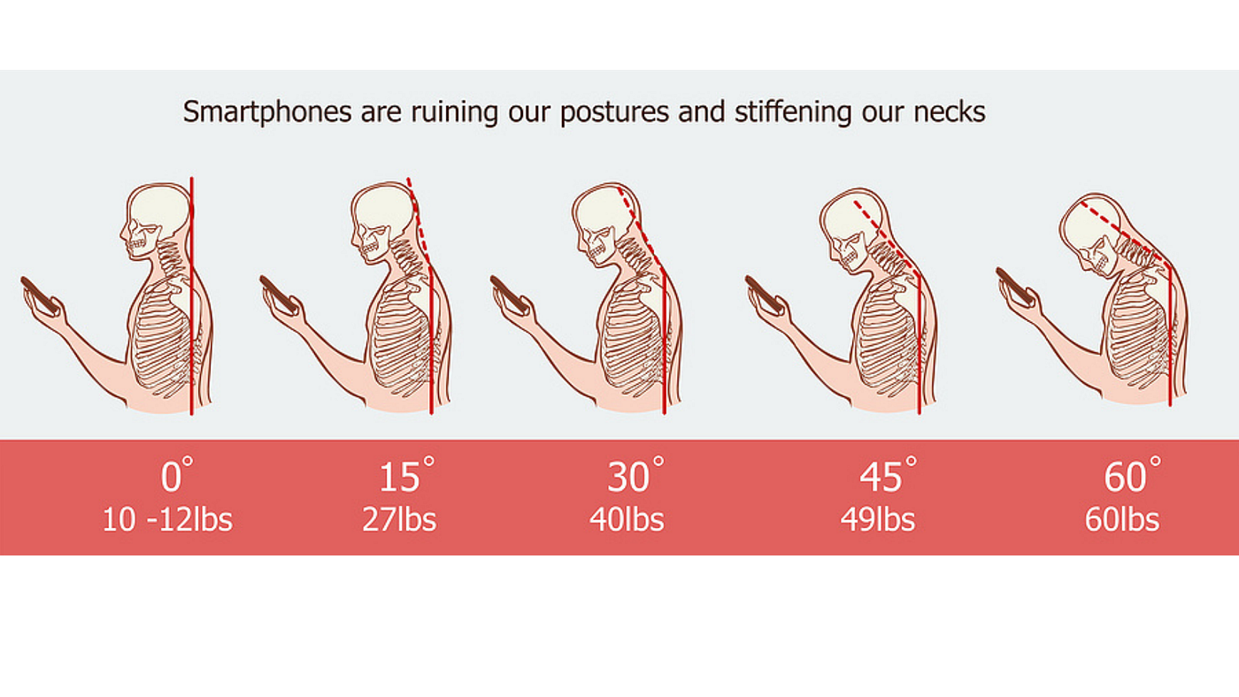 Neck Hump Correction