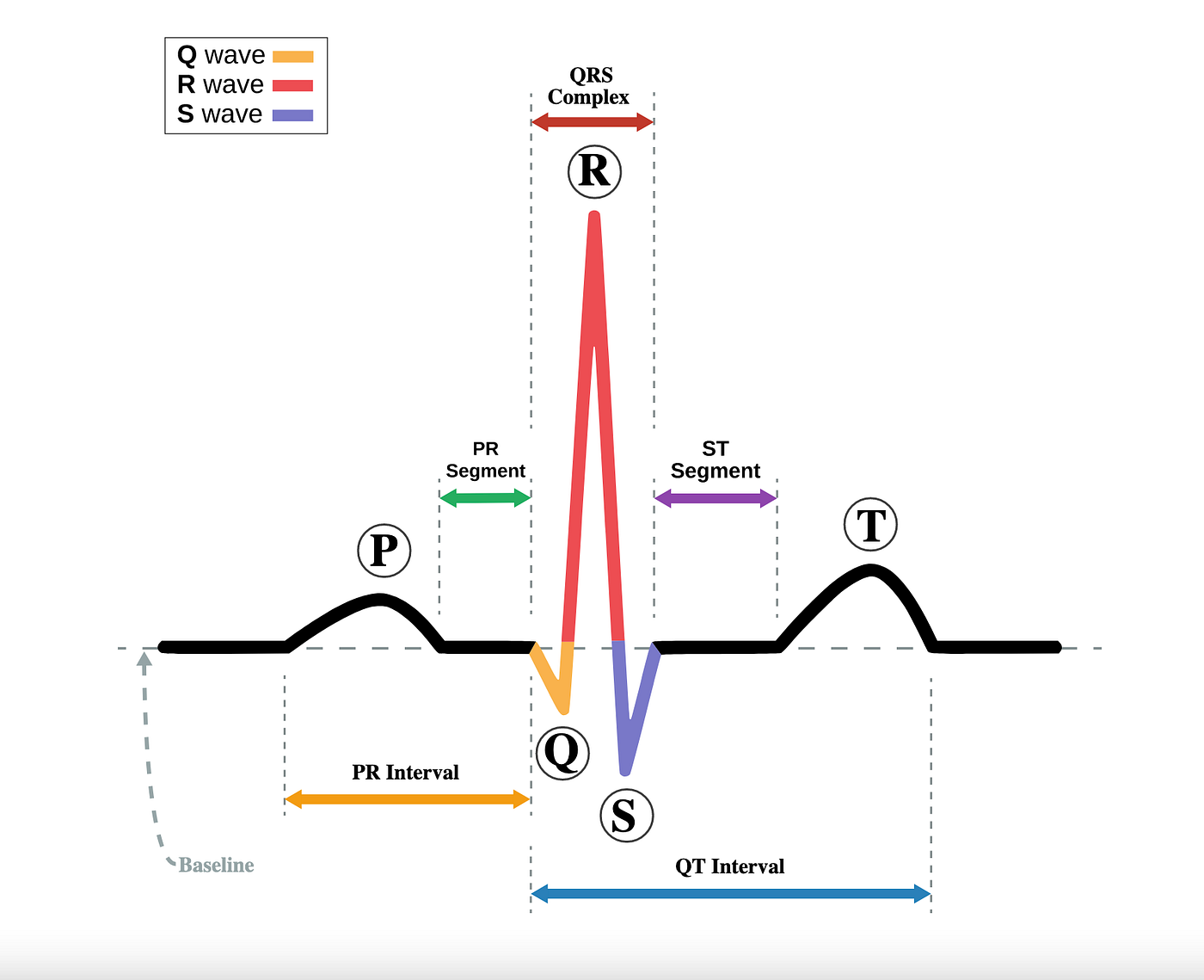 Ekg Interpretation Pqrst