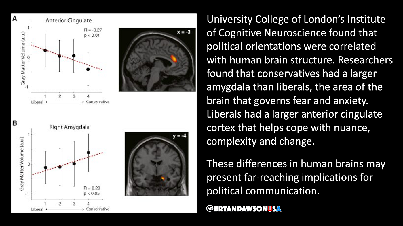 Brain Of A Conservative Republican