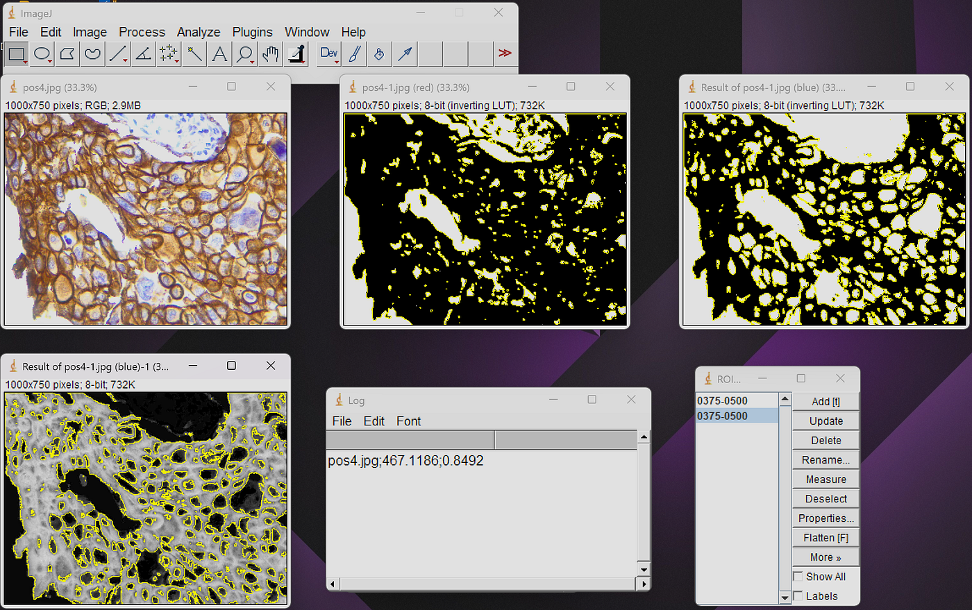 Imagej Measuring Area Measurements & Regions Of Interest · Analyzing