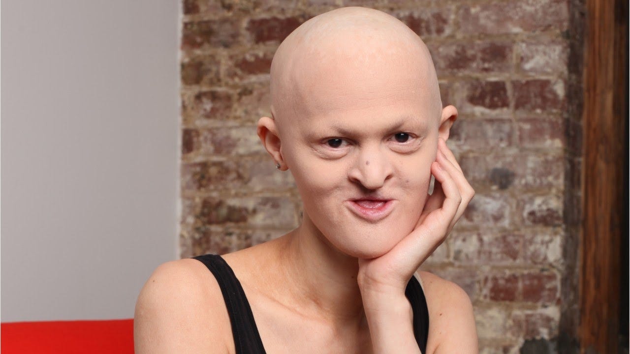 Unconventional Beauty Model