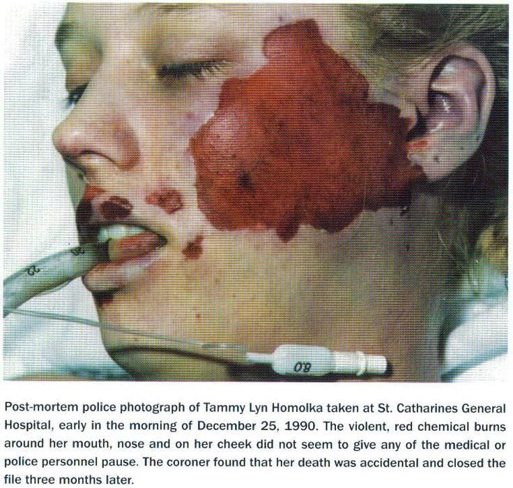 Fotos De Autopsia De Tammy Homolka SERIAL KILLER: Paul Bernardo