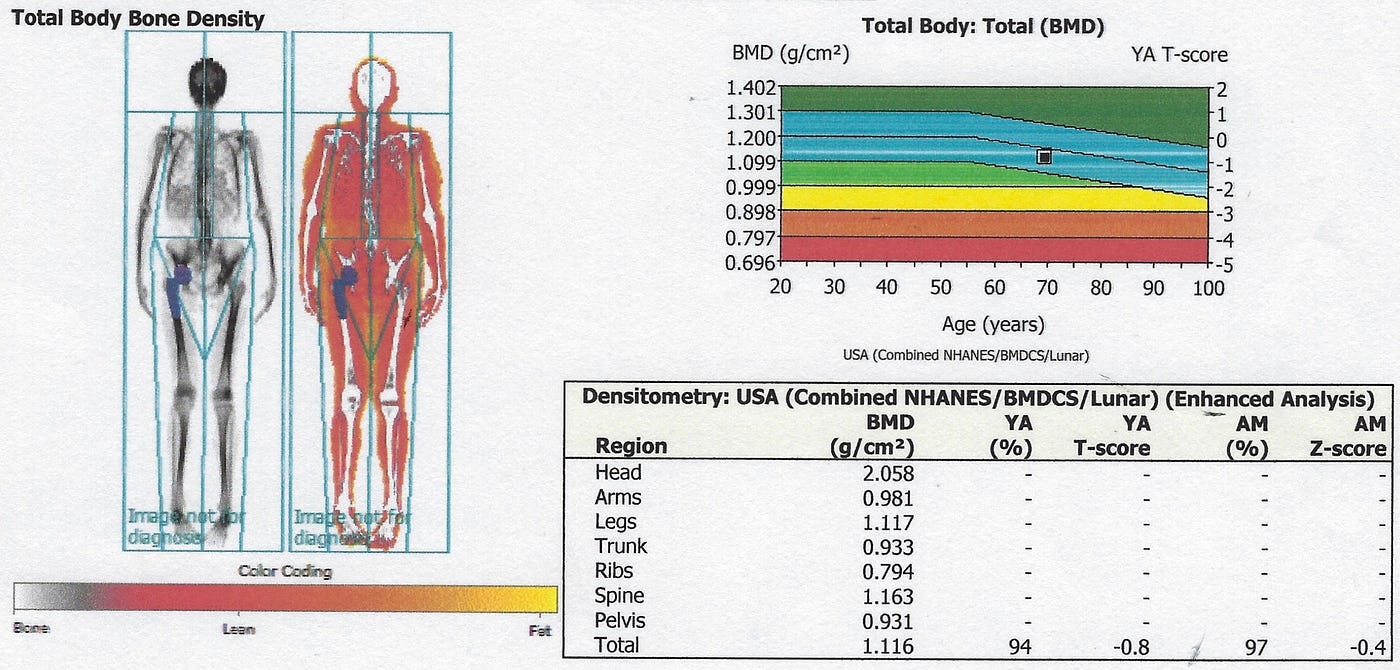 Body Fat Diagram