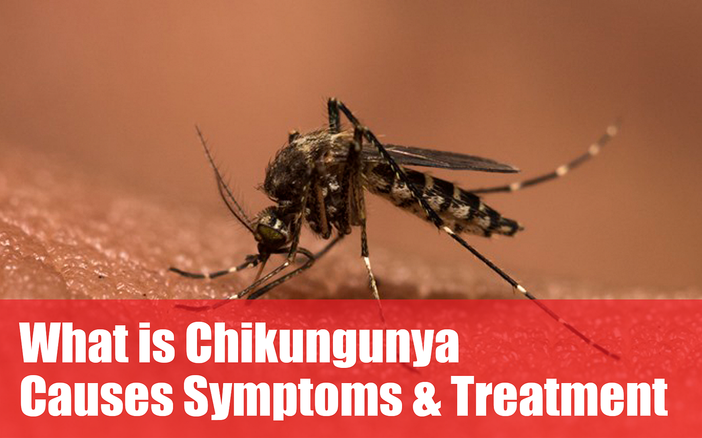 Chikungunya Symptoms And Diagnosis