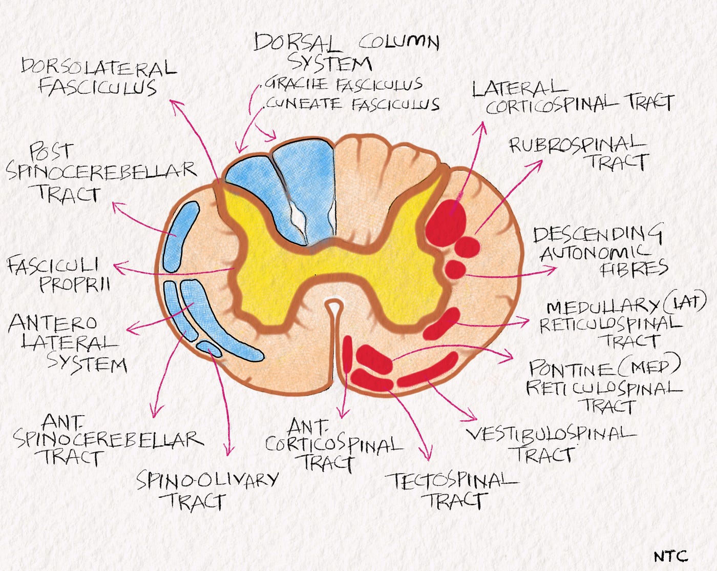 Syringomyelia Cross Section The Spinal Cord Anatomy And Syndromes.