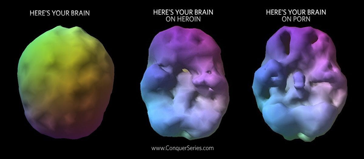 Heroin Brain Before And After