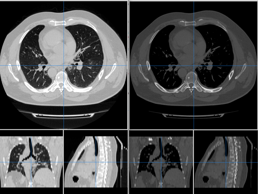 Medical Images For Image Processing