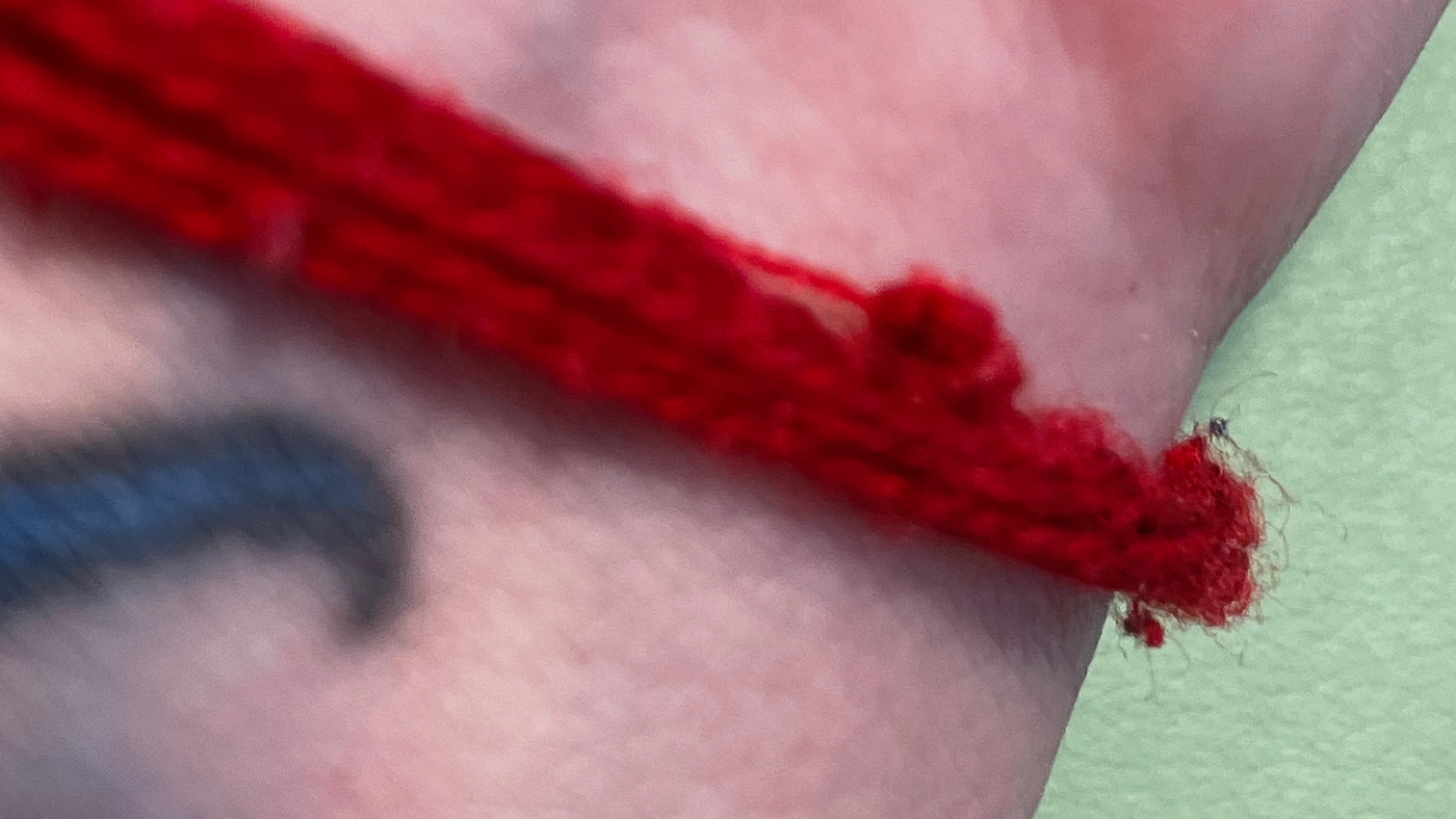 Ligature Marks On Wrists