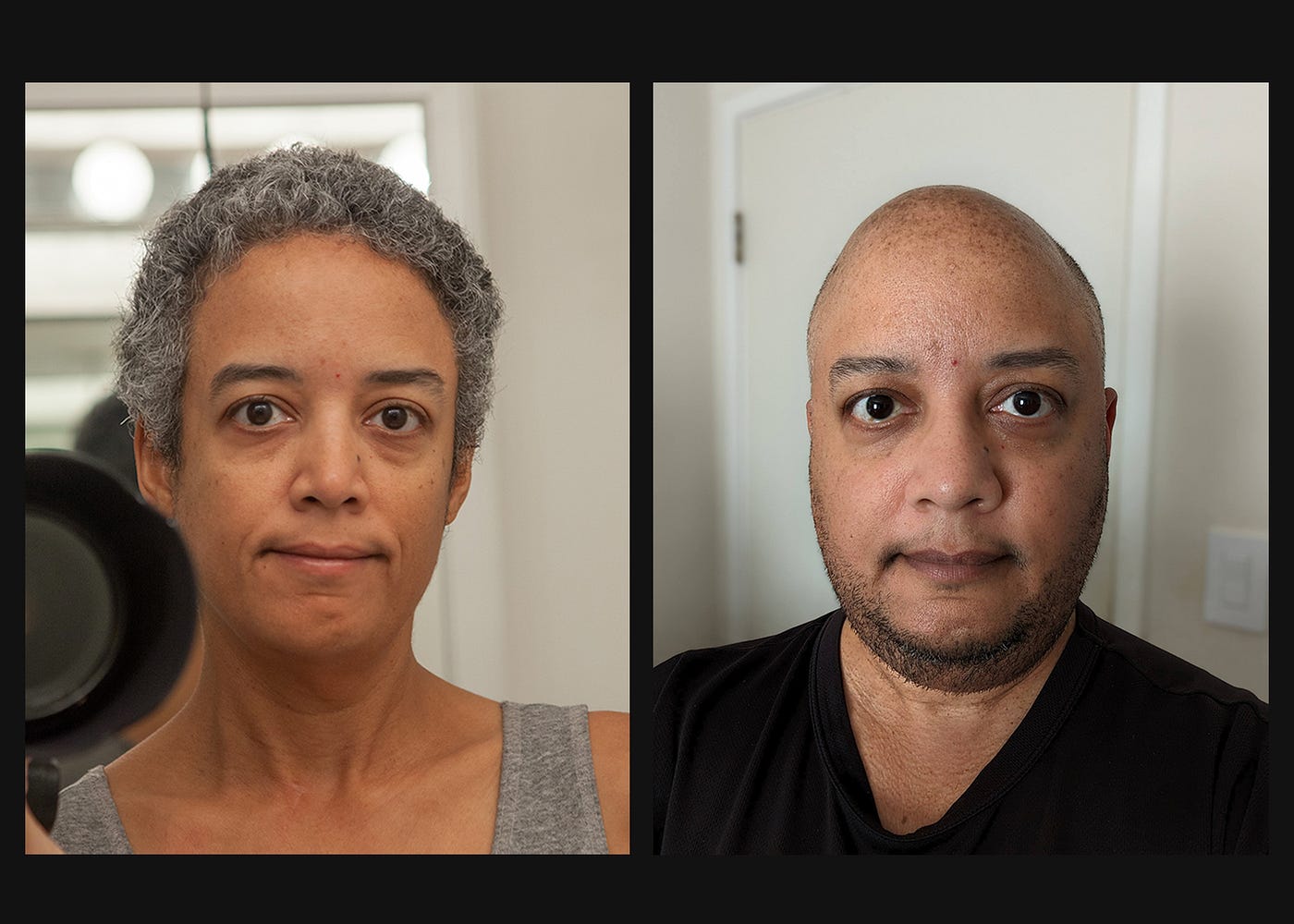Female To Male Before And After Testosterone Pictures