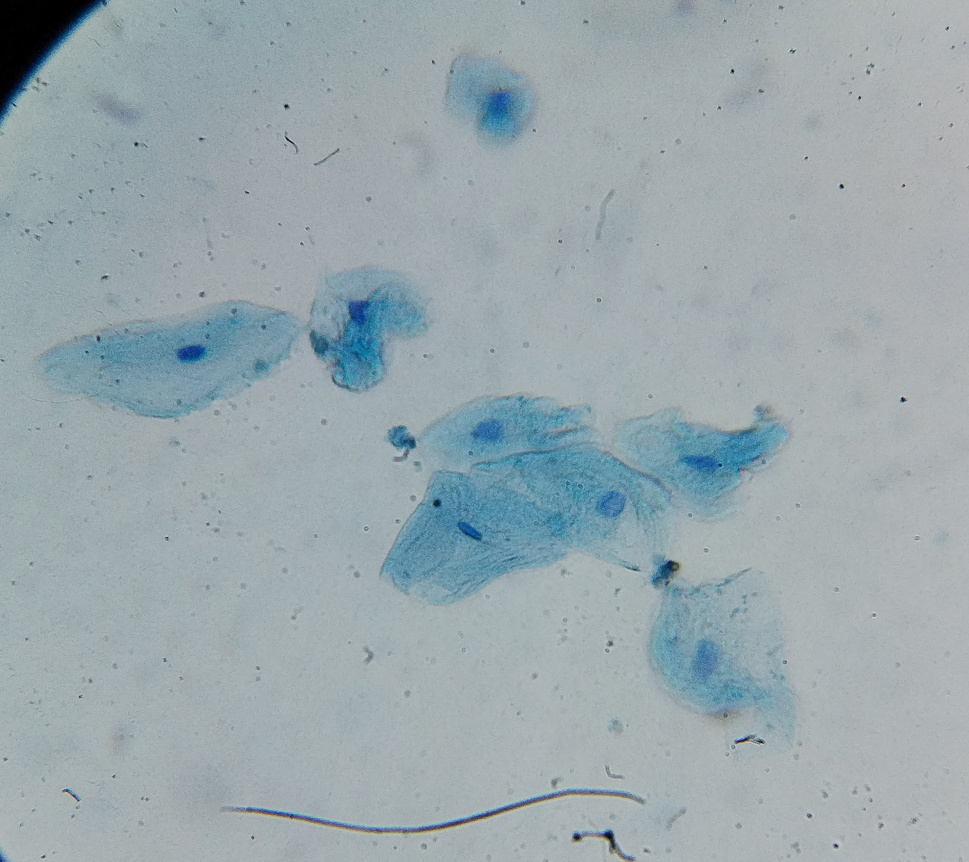 Human Cheek Cell 10x
