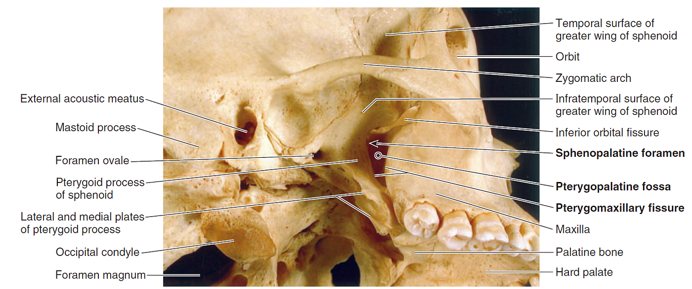 Pterygomaxillary Fissure And Pterygopalatine Fossa Infratemporal