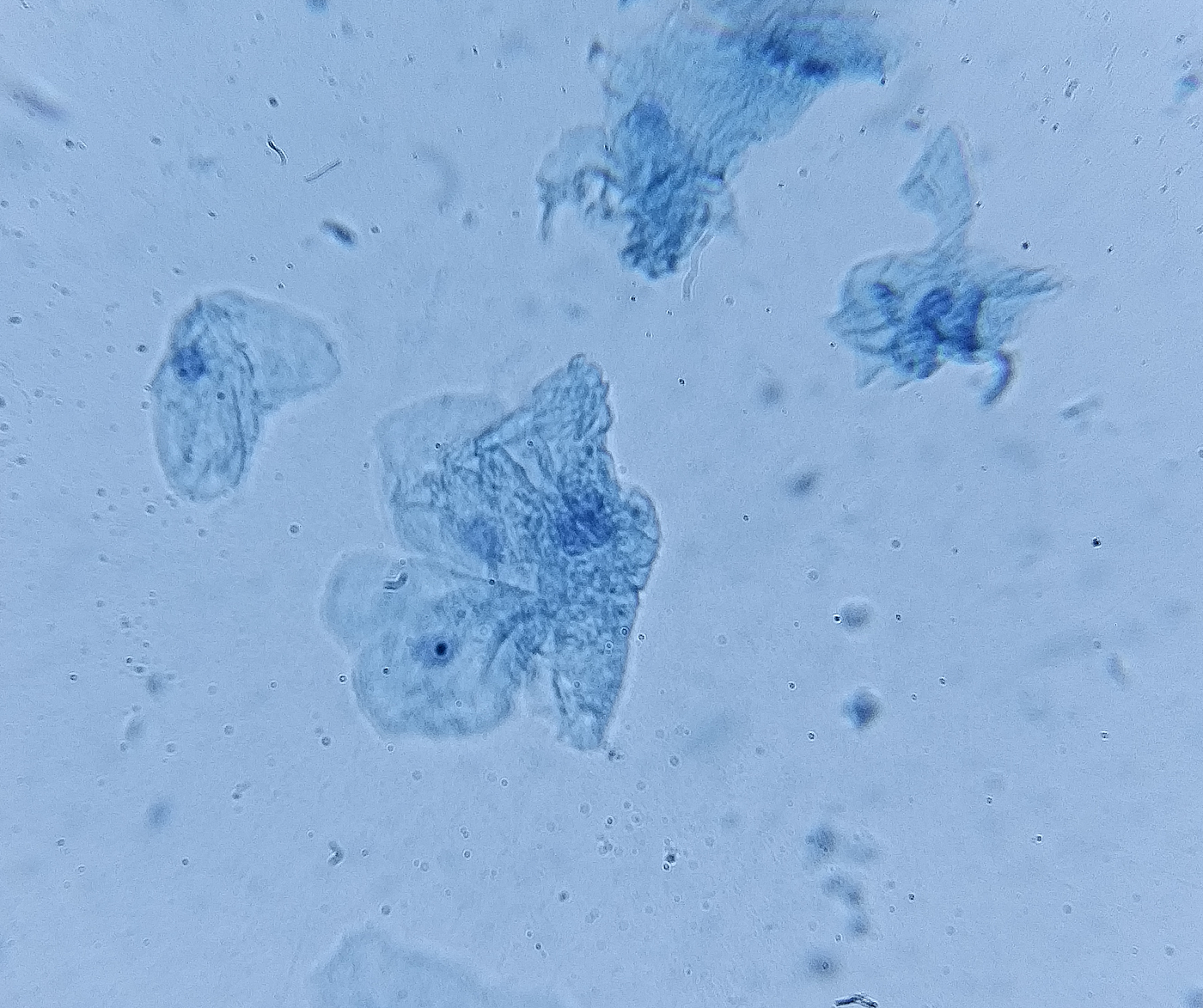 Human Cheek Cell 10x