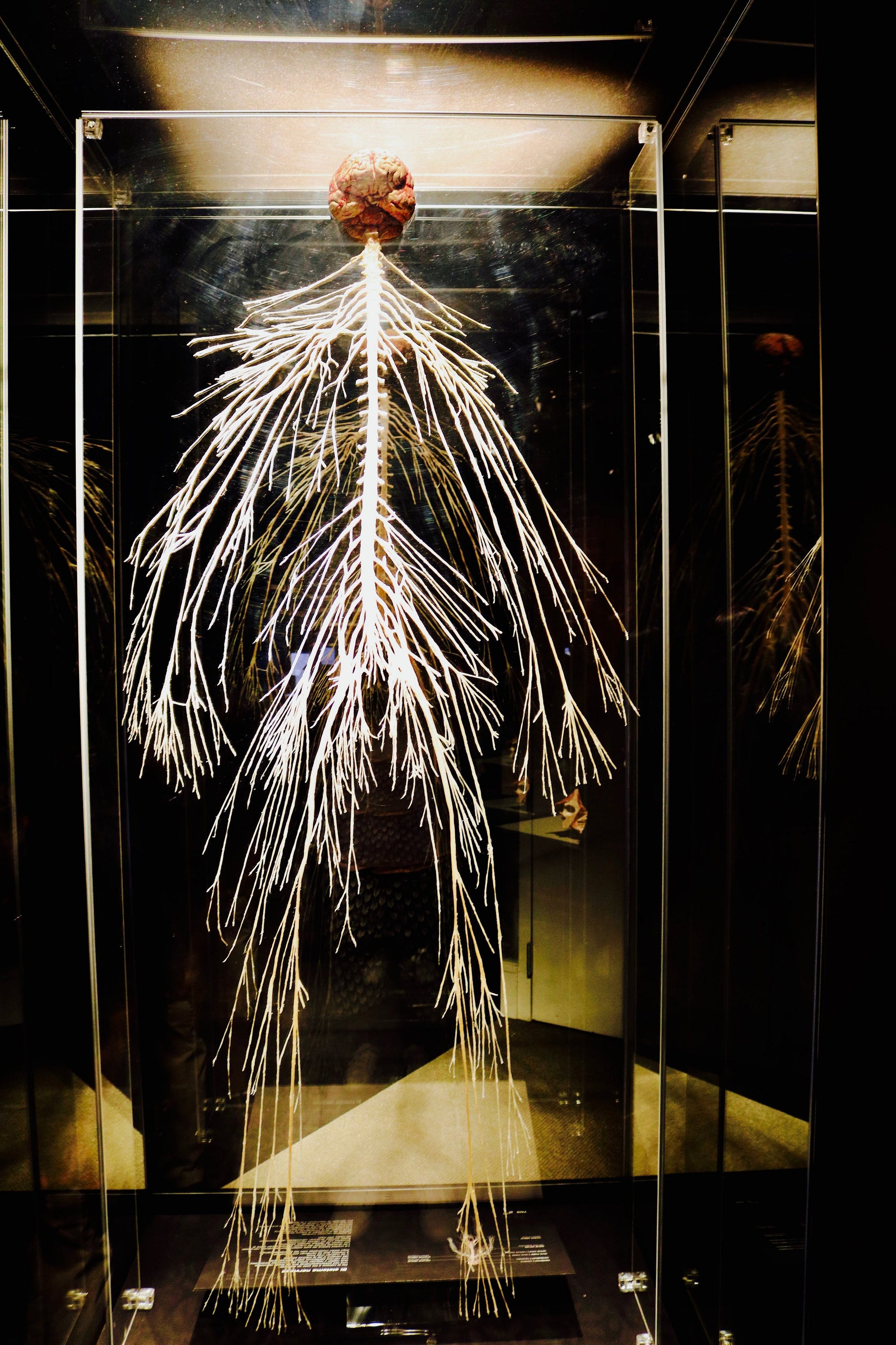 Human Body Exhibit Nerves