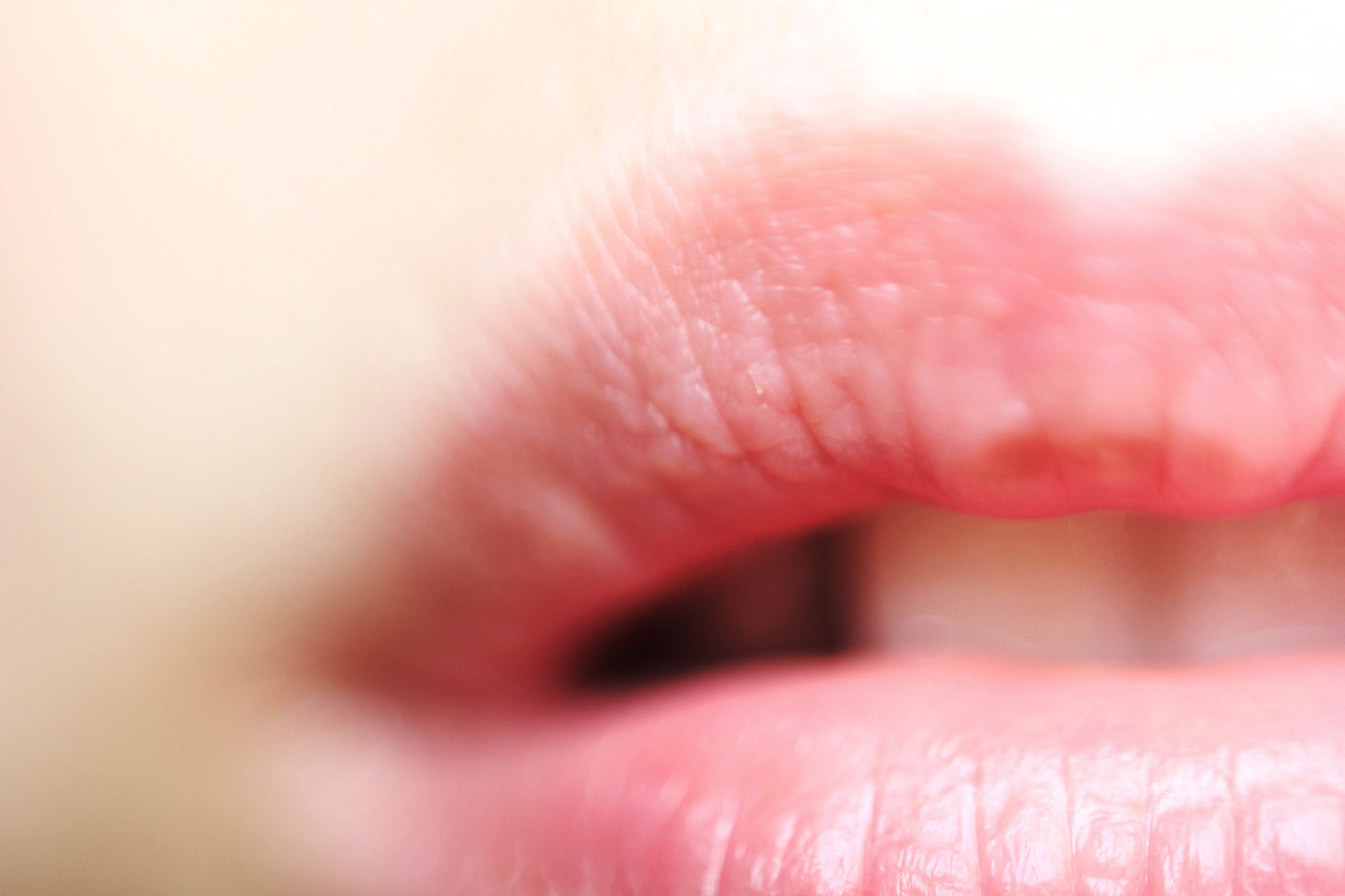 Vermillion Border Of Mouth