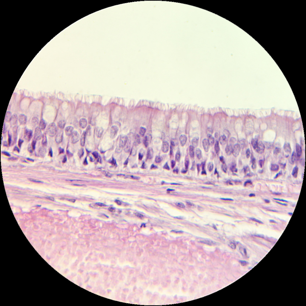 Simple Columnar Epithelium With Goblet Cells