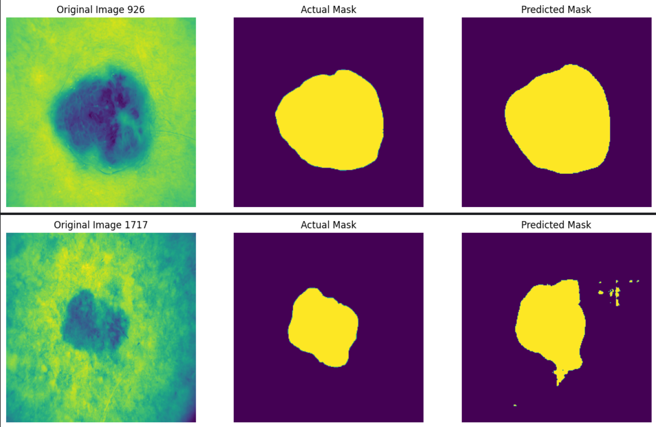U-net Unleashed: A step-by-step guide on implementing and training your own segmentation model ...