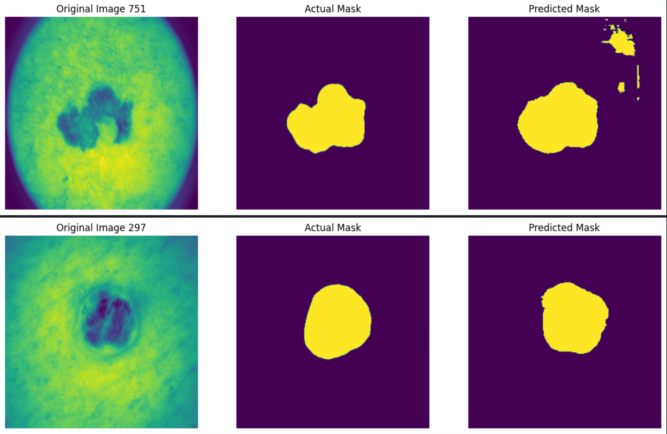 U-net Unleashed: A step-by-step guide on implementing and training your own segmentation model ...