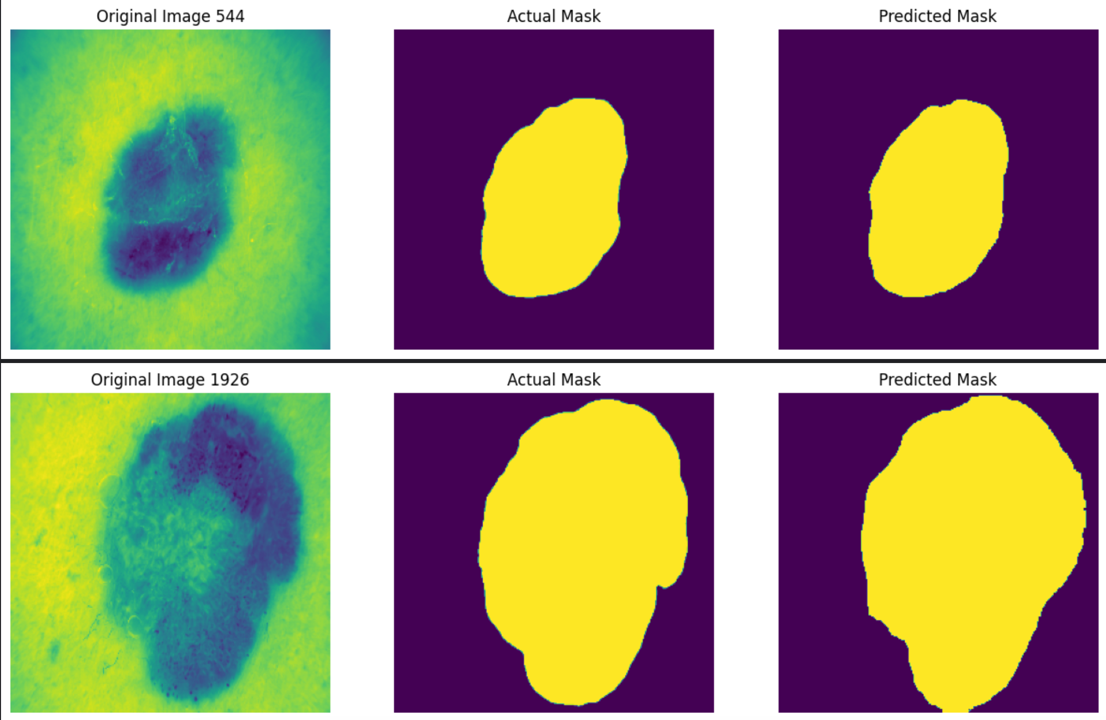 U-net Unleashed: A step-by-step guide on implementing and training your own segmentation model ...