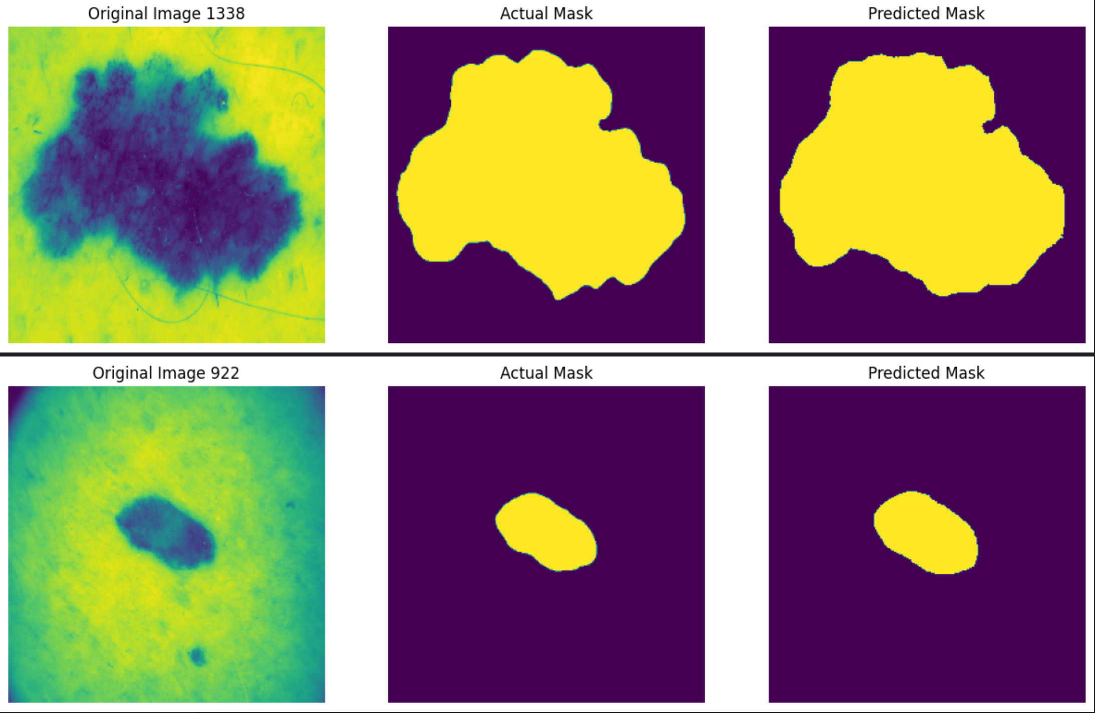 U-net Unleashed: A step-by-step guide on implementing and training your own segmentation model ...