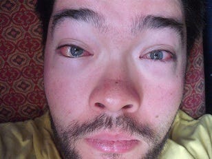 James Fowkes – Medium