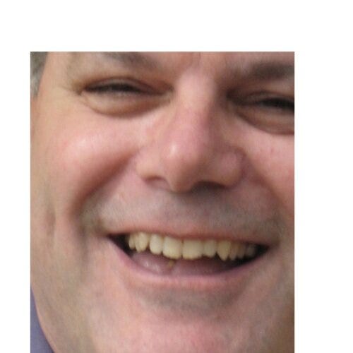 Bruce Stern – Medium