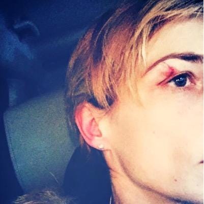 Lou Matzen – Medium