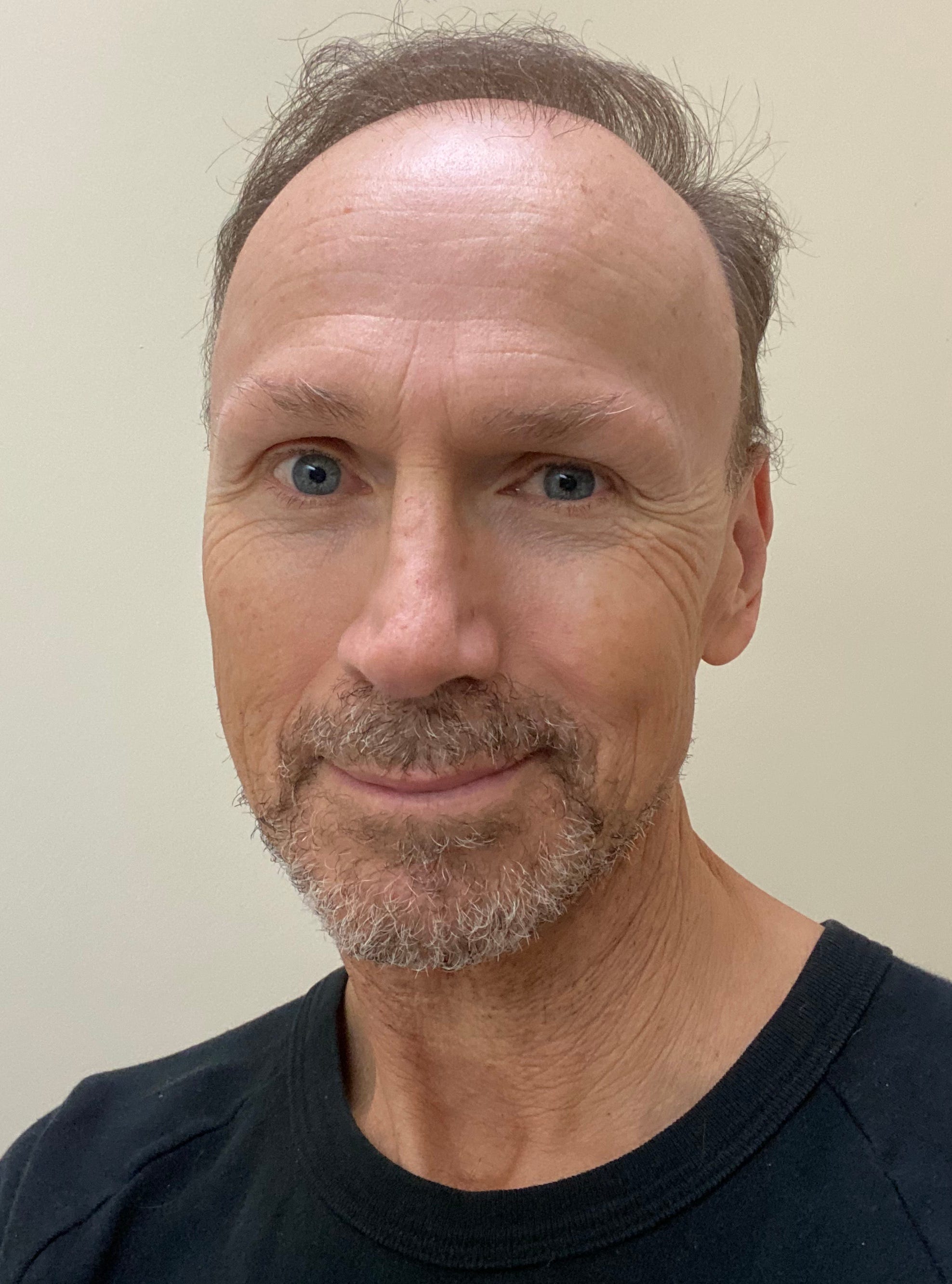 Anthony Gill – Medium