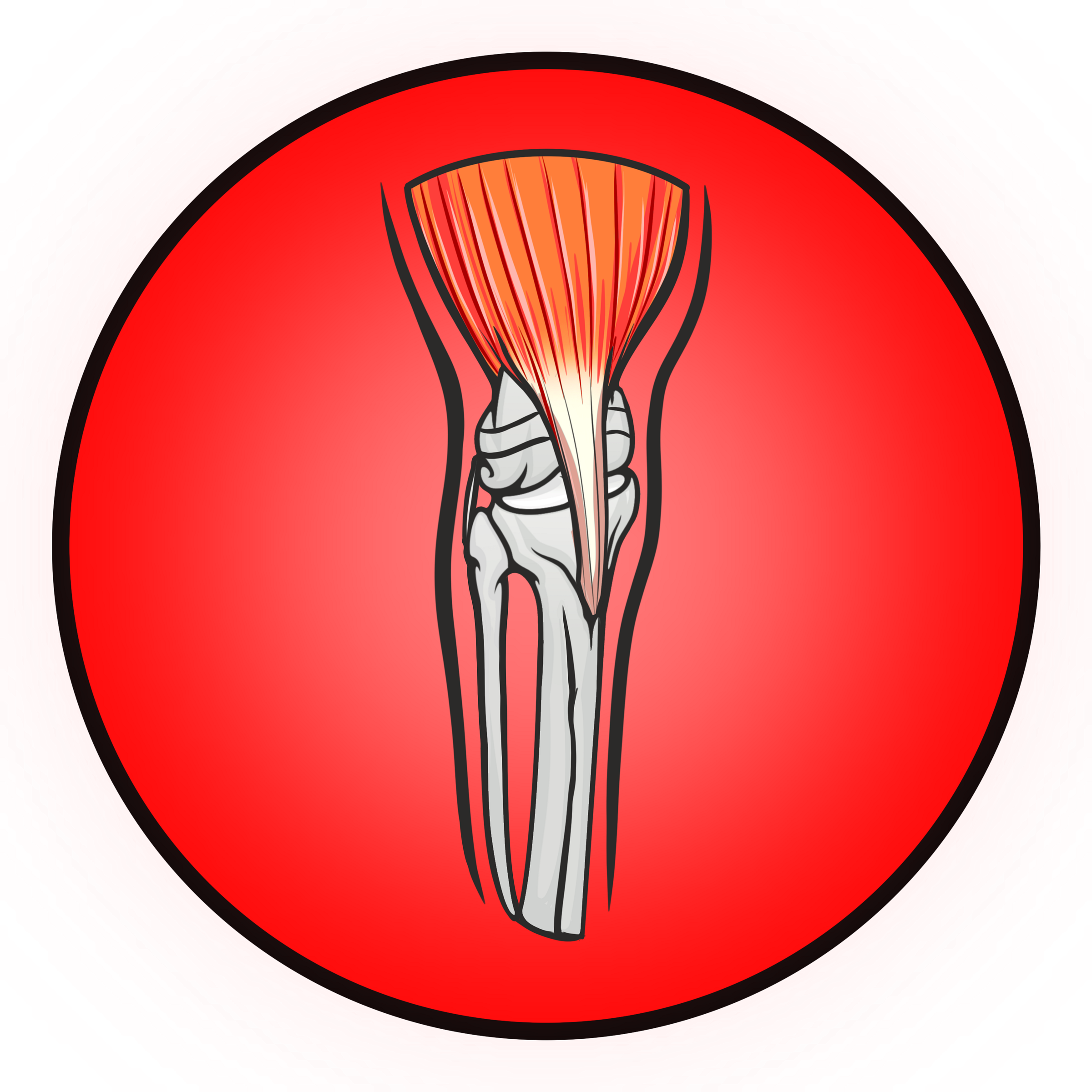 Tendon Bridge – Medium