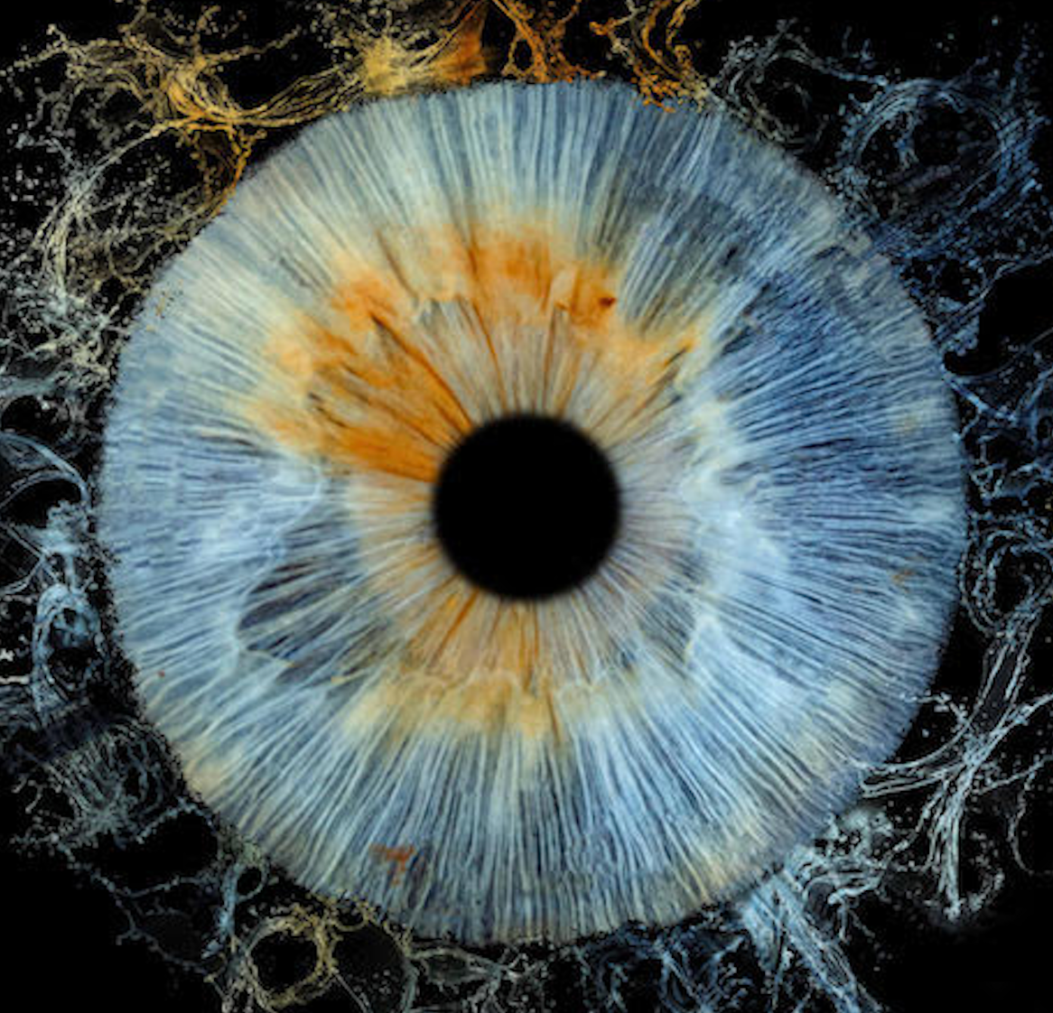 Tod Caton – Medium