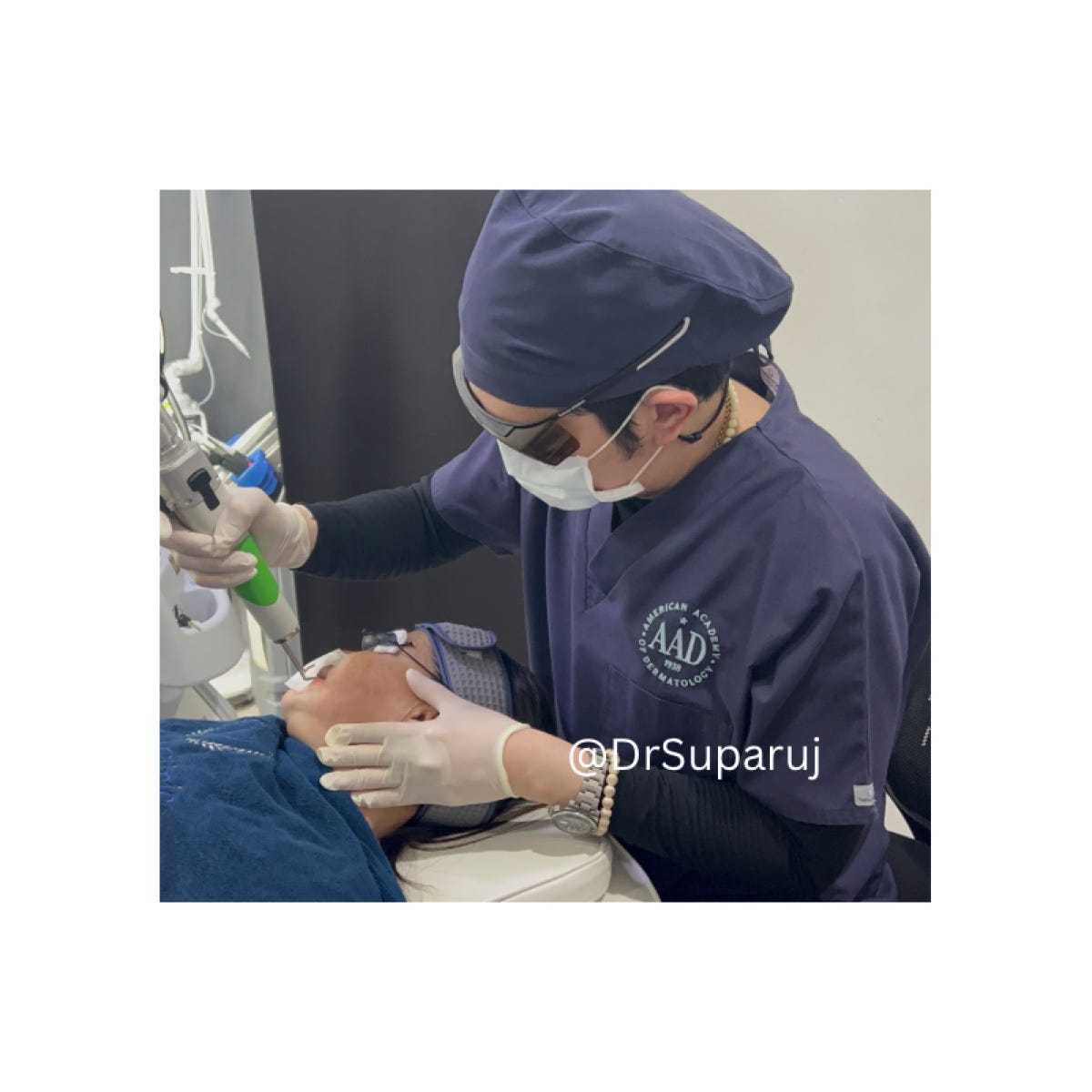 Dr. Suparuj หมอรุจชวนคุย Acne Scar Treatment – Medium