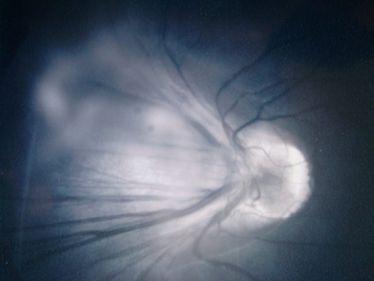 Mariana Medium