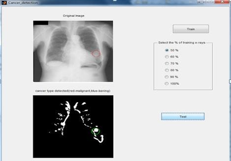 berna eser – Medium