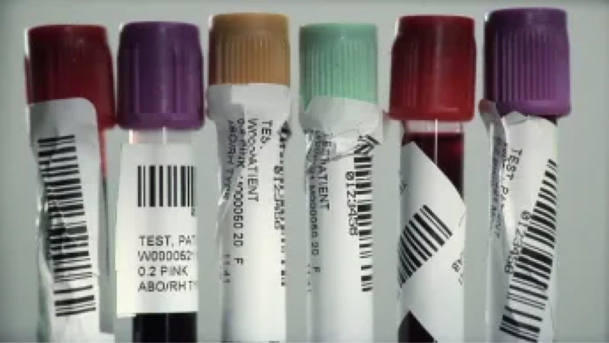 A. Calder – Medium