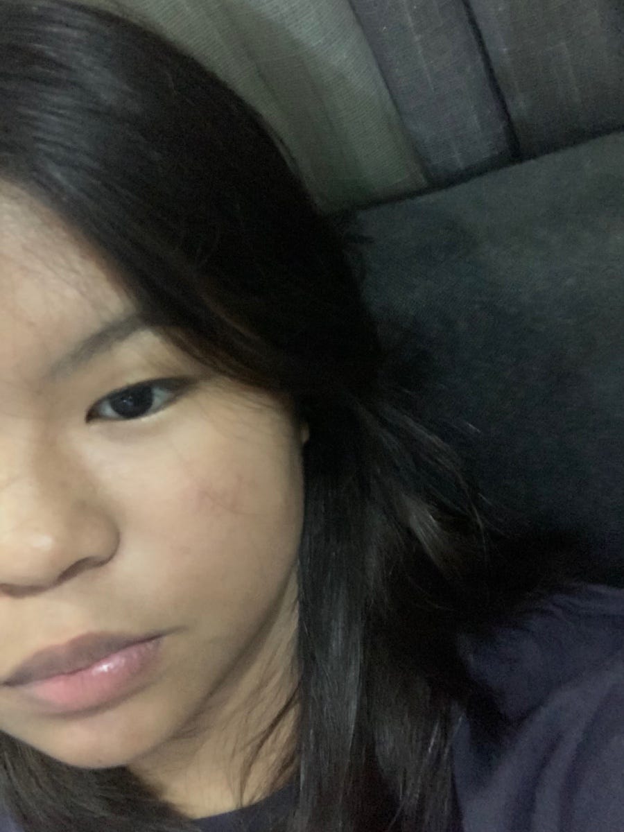 Lex Boquecosa – Medium