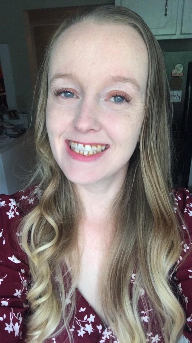 Kelly Duncan – Medium