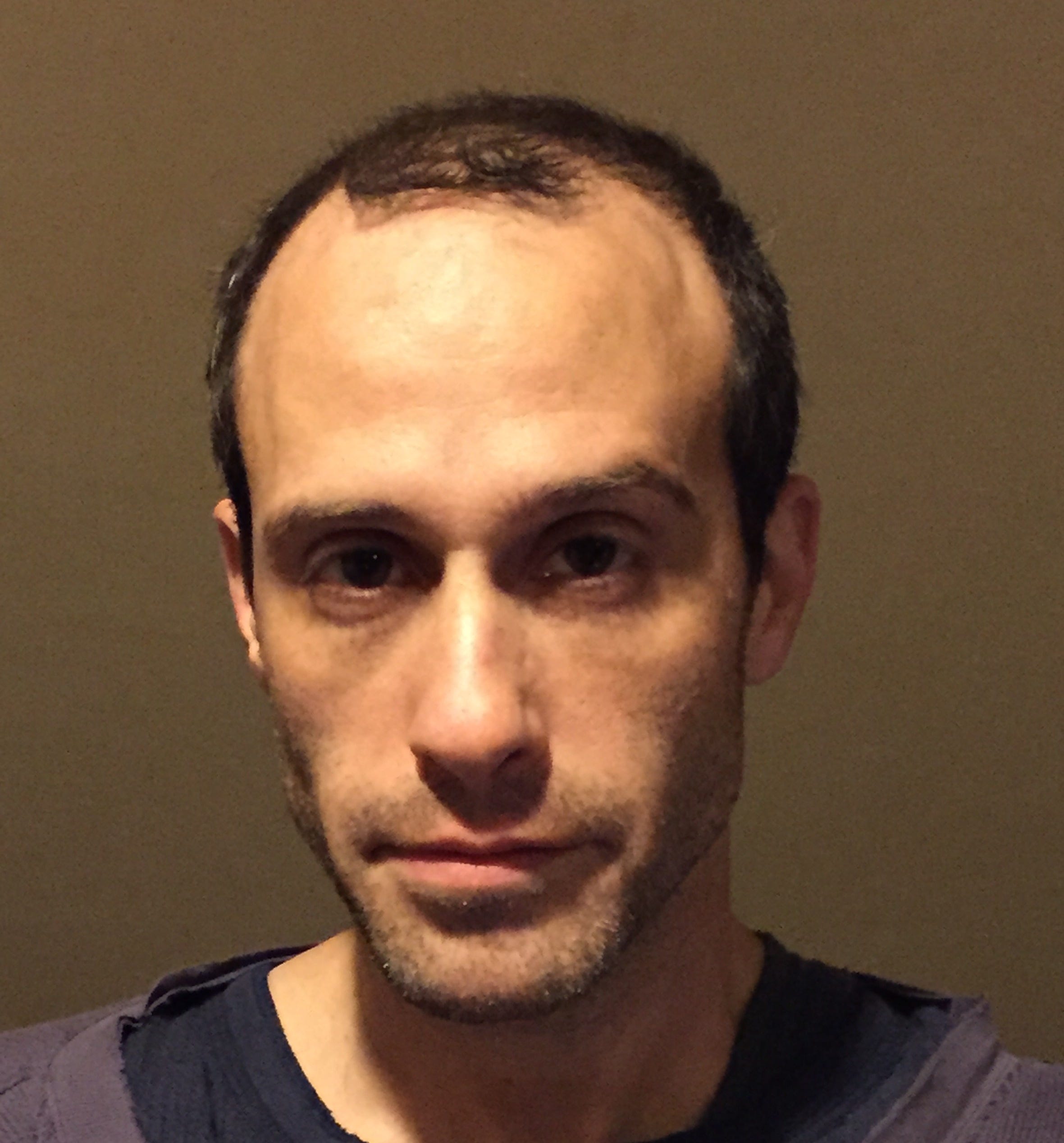 Charles Metzner – Medium