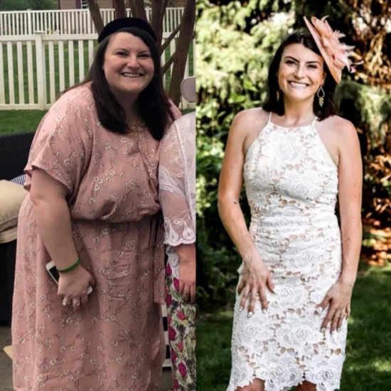 Extreme Weight Loss – Medium