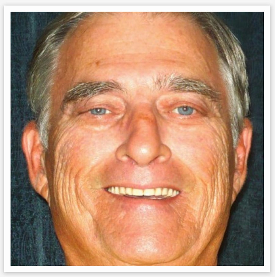 Ted Davis – Medium