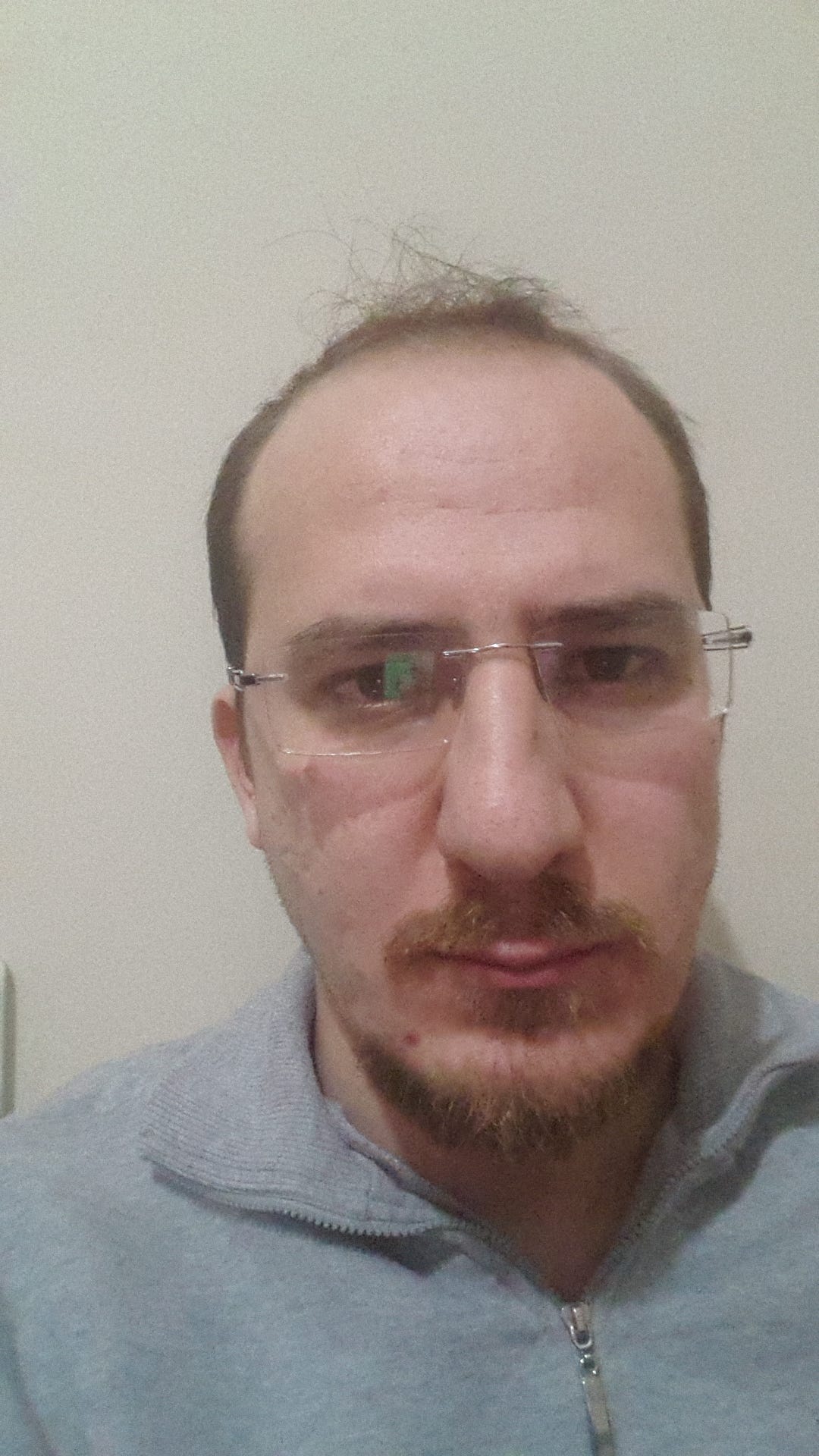 Alper Alp – Medium