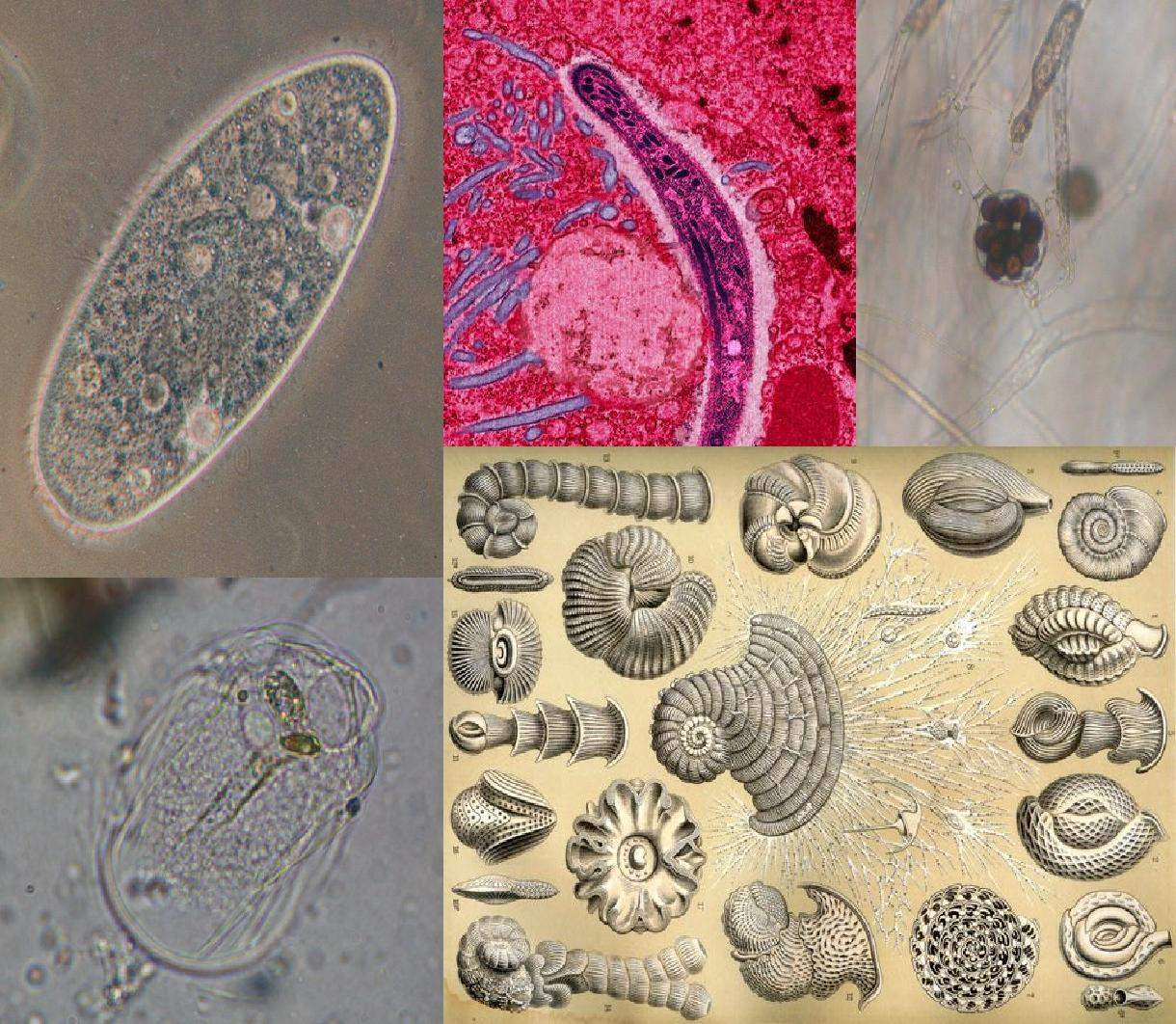Protists Microorganisms