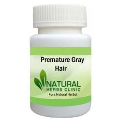 Herbal Treatment for Premature Gray Hair | Natural Remedies | Natural ...